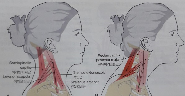 커뮤니티 > 피아니스트 질환 4. 거북목(Turtle neck) & 어깨통증(Shoulder pain)